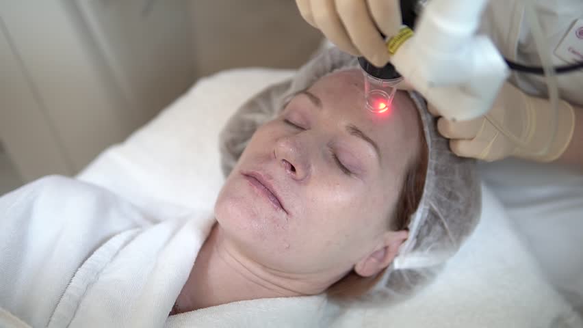 Resurfacing Facial Skin With A Laser. Modern Innovative Medical ...