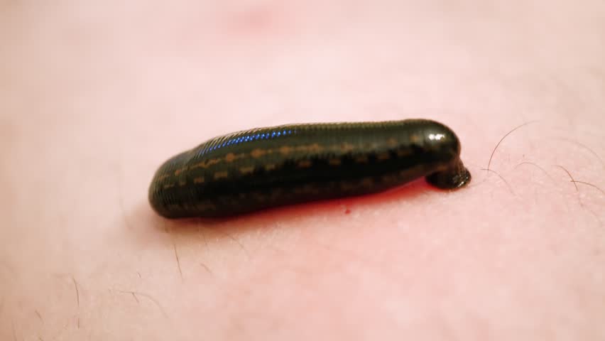 Leech Stock Video Footage - 4K and HD Video Clips | Shutterstock