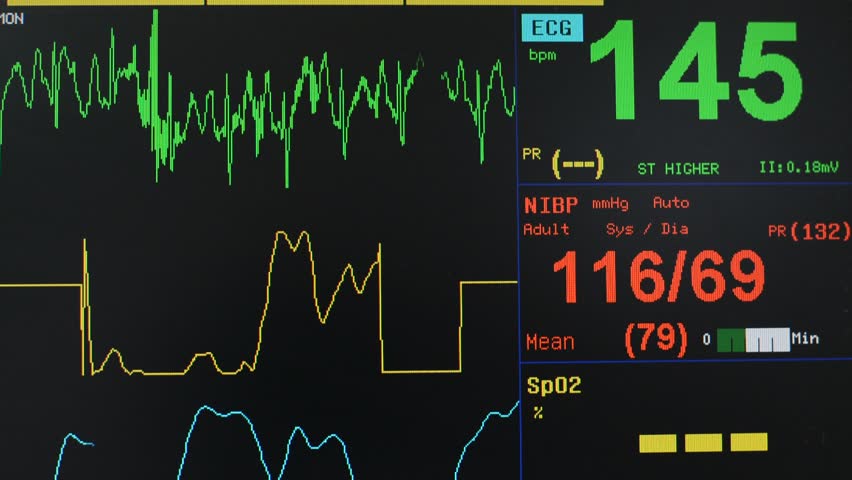Physician Points Out Heart EKG, Respiration Measurements Displayed On ...
