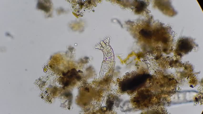 Heliozoa Or Sun Animalcule Under Microscope, Magnif 400x Stock Footage ...