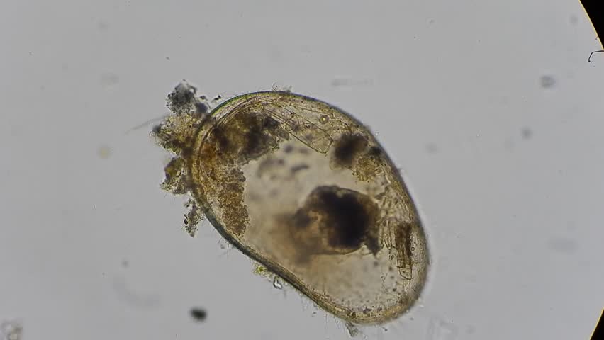 Stock Video Clip of dead garbage under microscope, magn 200x | Shutterstock