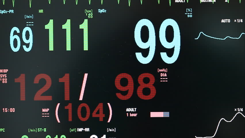Electrocardiogram Animation