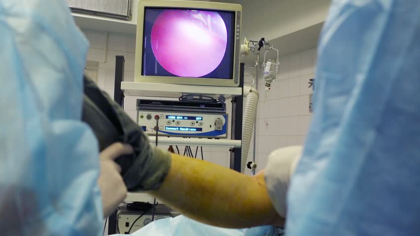 Hands Of Doctor During Endoscopy Surgery On Knee Joint Stock Footage ...