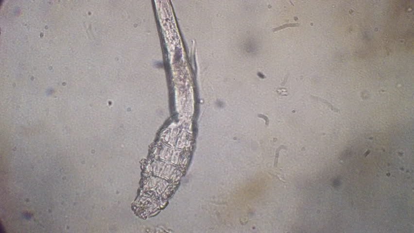 Demodectic Mange, Demodex (demodex Canis) Stock Footage Video (100% ...