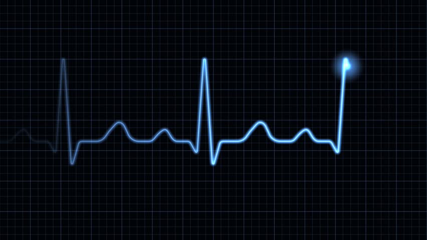 Animation Of Schematic Diagram Of Normal Sinus Rhythm For A Human Heart ...