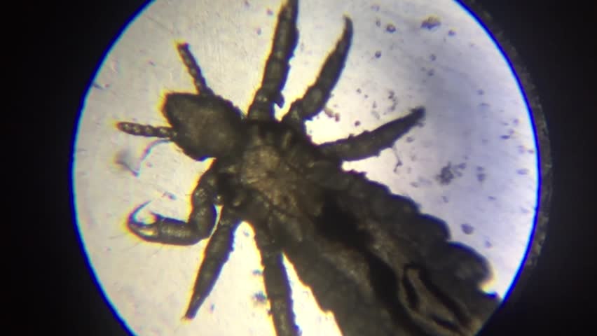 Macro Shot Of Head Lice (louse) On White Background Stock Footage Video ...