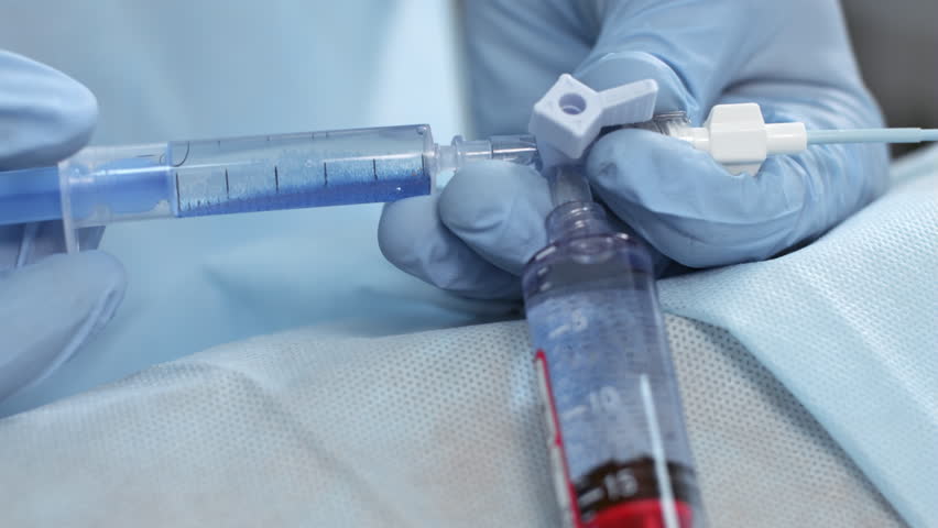 Embospheres Stock Footage Video | Shutterstock