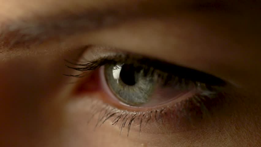 Female Red Eye Looks Up, Left Right And Down. Redness Resembles Pink ...