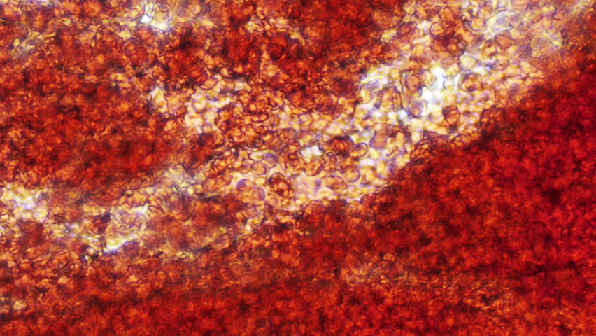 Blood Plasma Torrent Cells Passage Microscope Slide 400x Magnification ...