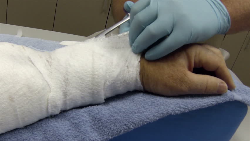 Stock Video Clip of Medical doctor cutting surgical bandage off patient ...