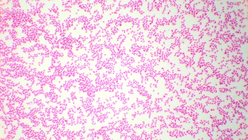 Fish Blood Cell Under a 스톡 동영상 비디오(100% 로열티프리) 8886628 | Shutterstock