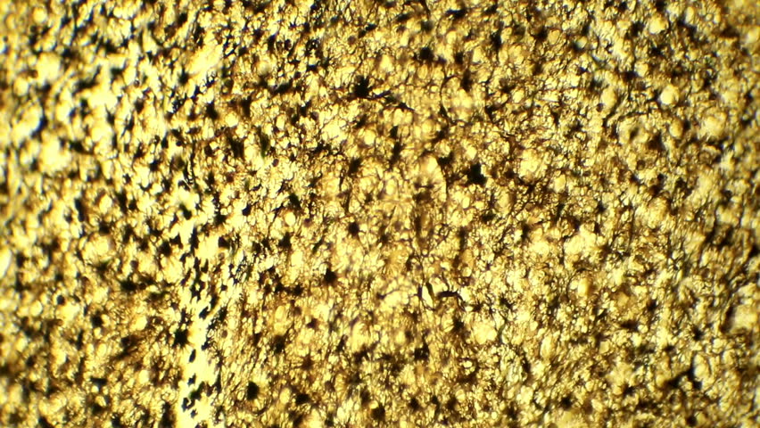 Frog Skin Under the Microscope Stock Footage Video (100% Royalty-free ...