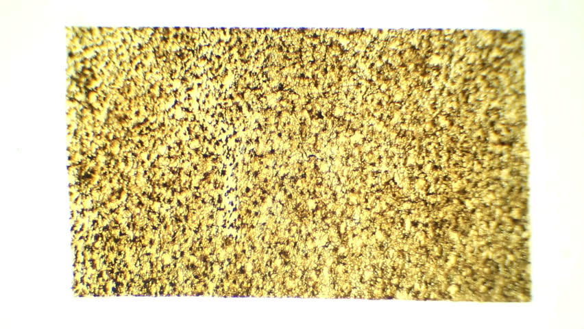 Frog Skin Under the Microscope Stock Footage Video (100% Royalty-free ...