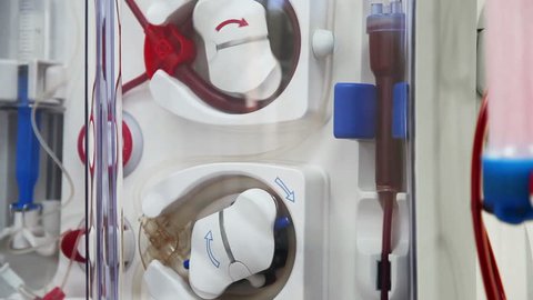 Dialysis Stock Video Footage - 4K and HD Video Clips | Shutterstock